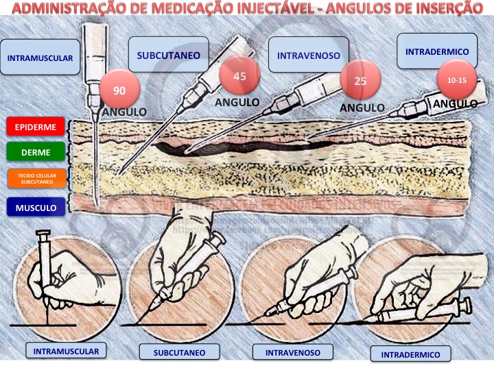 Viver Enfermagem em Cuidados Intensivos: Fevereiro 2017