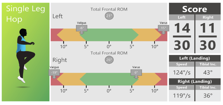 Move to Improve: Limb Symmetry Index: What is it and Is it important ...