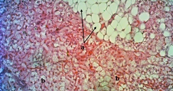 Atlas Histológico UNIFOR-MG: Tecido adiposo unilocular e multilocular