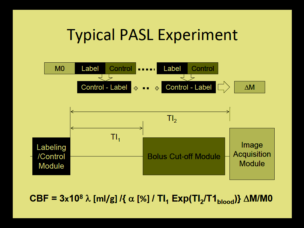MRI BLOG: Arterial Spin Labeling (ASL)