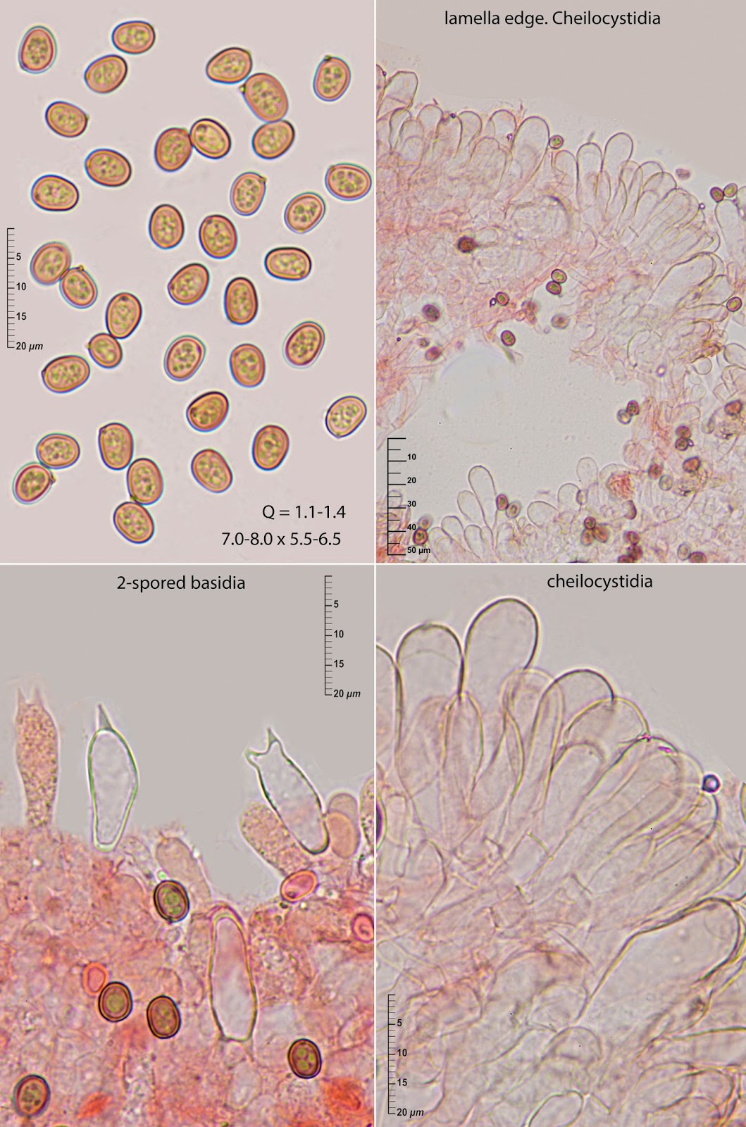 Agaricus bisporus (J. E. Lange) Imbach • CEMAS Orden Agaricales