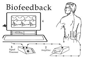 Chronic Pain: Dr Richard Sherman Discusses Headaches and Biofeedback