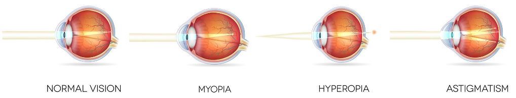 Mag het een beetje meer zijn: 34. Druppelboekhouden