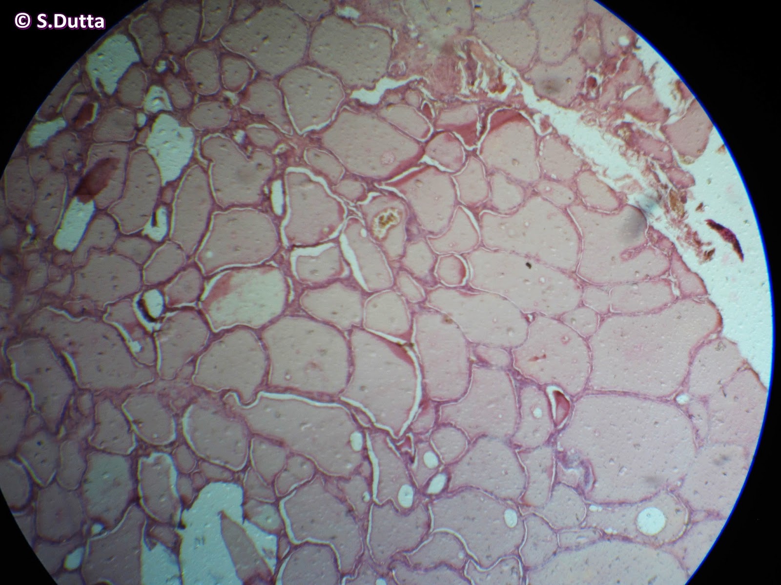 CNMC-ROLL: HISTOPATHOLOGY EXAM SLIDES