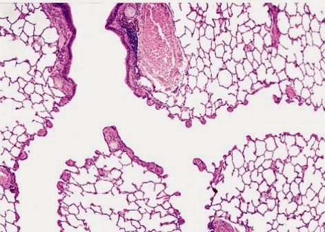 Histologia Sistema Respitaorio: Arbol Bronquial