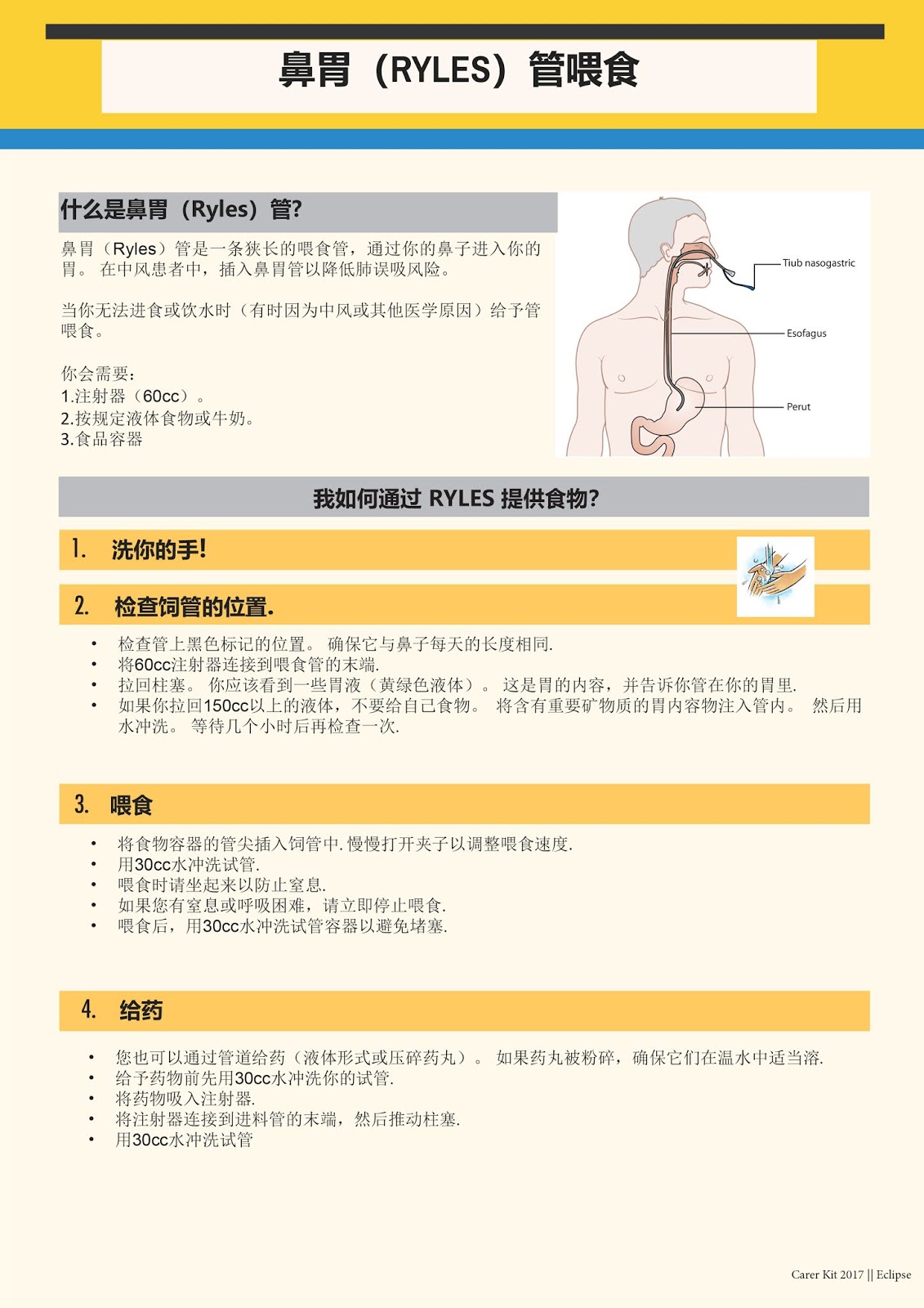 Carer Training Information: 鼻胃(RYLES)管喂食 Carer Training Information: 鼻胃(RYLES)管喂食