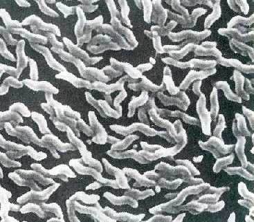 Rong's Bugs: Campylobacter spp