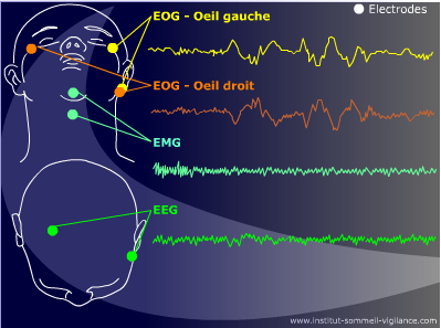 Le sommeil paradoxal (TPE): II) Le cerveau