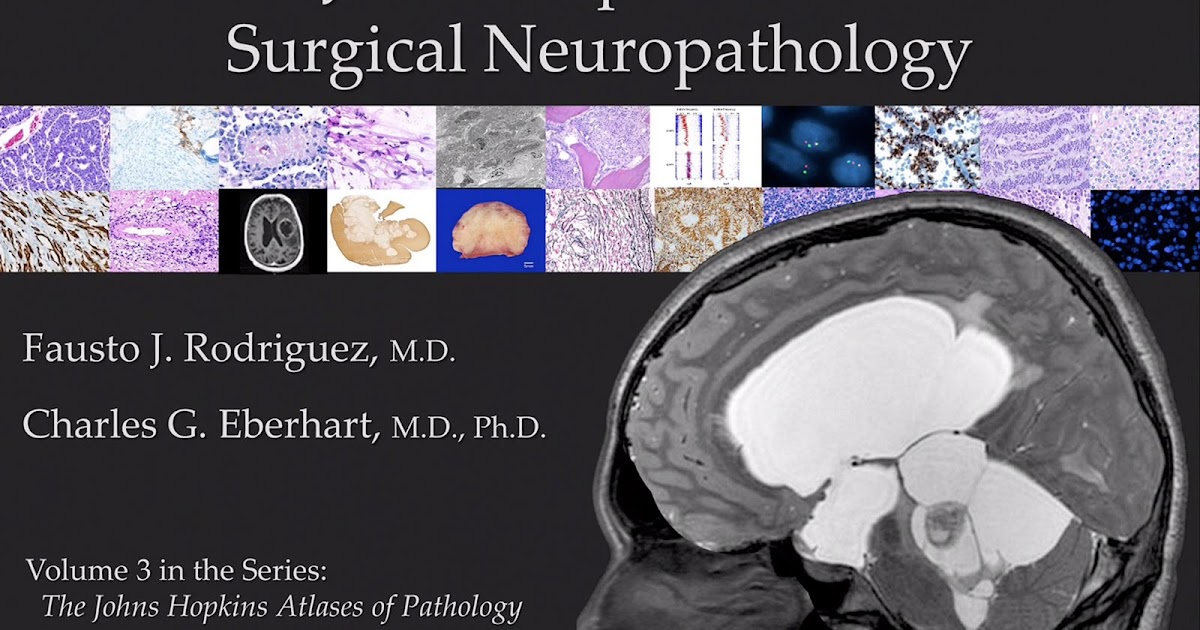 neuropathology blog: Screenshots of the surgical neuropathology volume ...