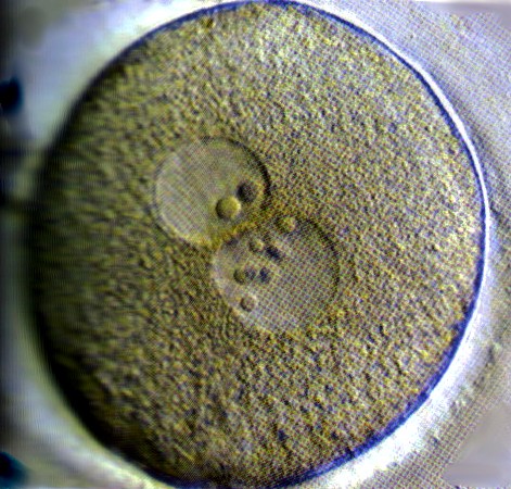 Compromised Fertility: Good News!