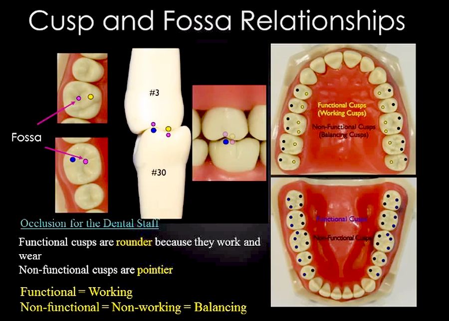 Webinar Occlusion For Prosthodontics Edilia Marshall Dmd Magd Aaacd