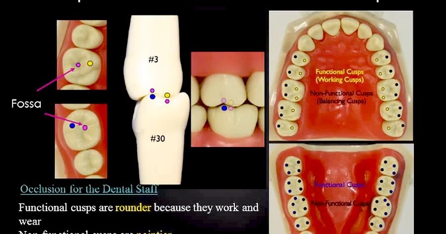 REVIEW: Occlusion for Prosthodontics - Edilia Marshall, DMD, MAGD ...