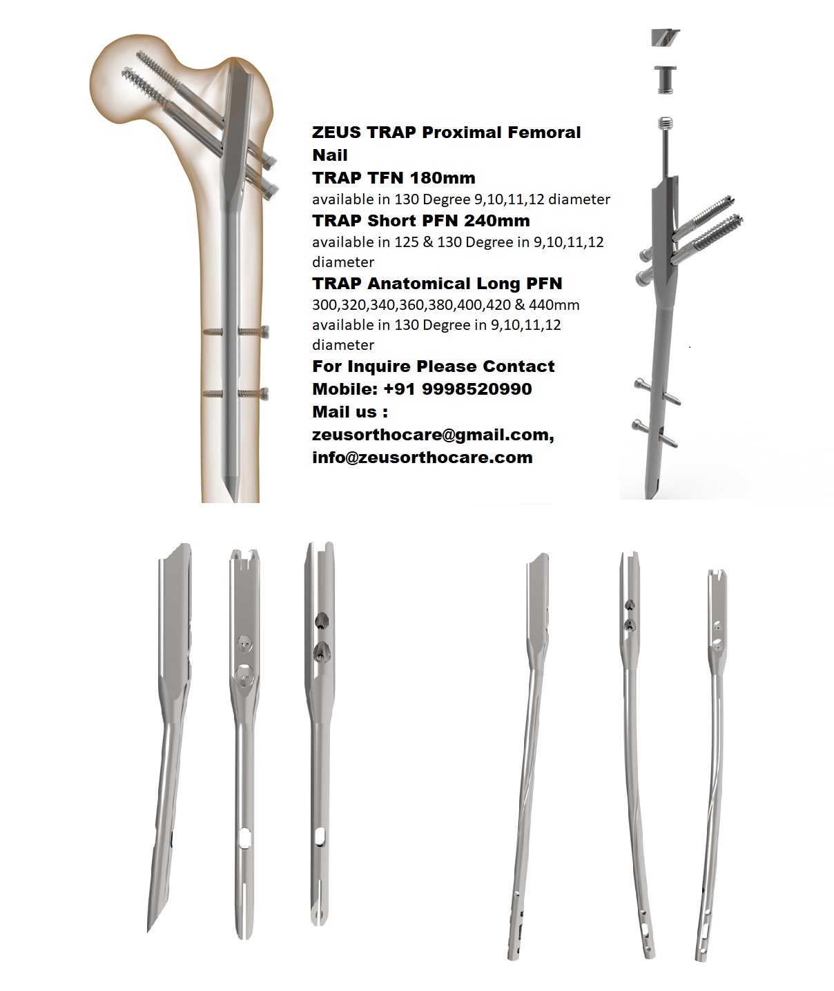 ZEUS TRAP Proximal Femoral Nail