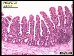 Sistem pencernaan, Usus halus, usus besar, dan Anus - Biologi Edukasi ...