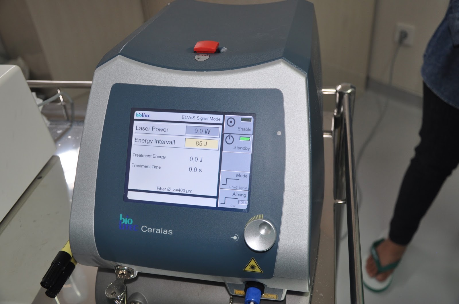 Bedah Vaskular Dan Endovaskular Indonesia: Demo penggunaan laser terapy ...