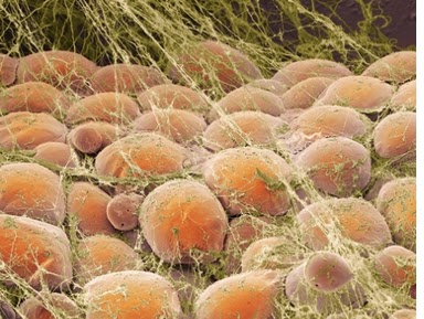 Annicas ekologi : Några miljögifter (PCB; Kvicksilver och dioxiner)