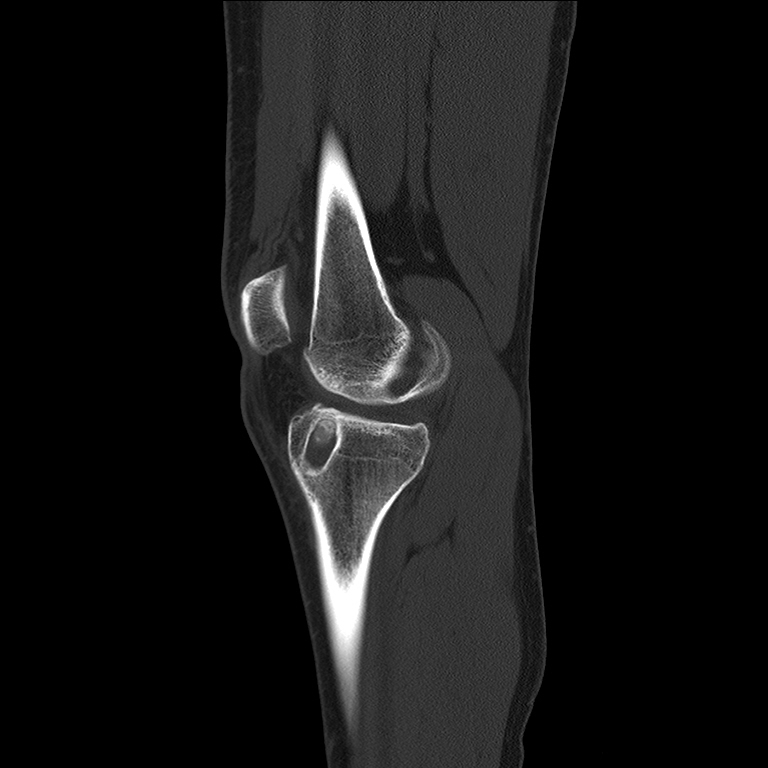 CT Knee - Radiology Imaging