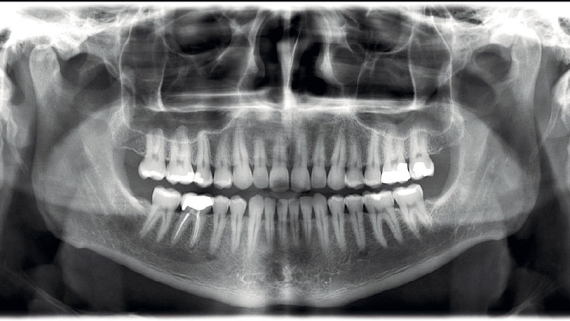 Radiología Estomatologica : 2017