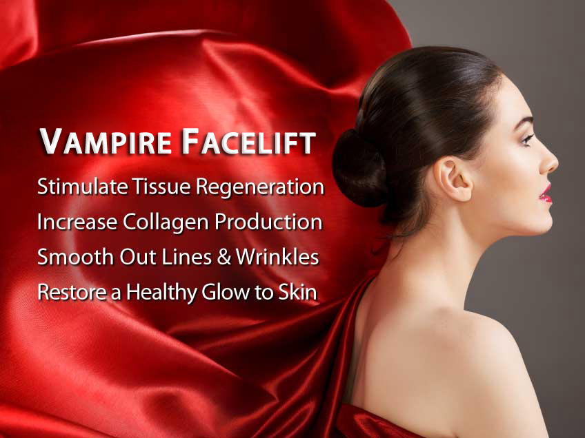 Vampire Face-lift