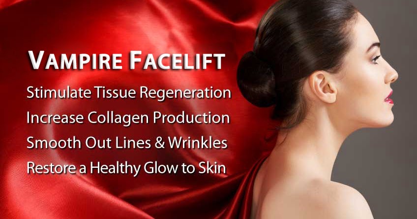 Vampire Face-lift