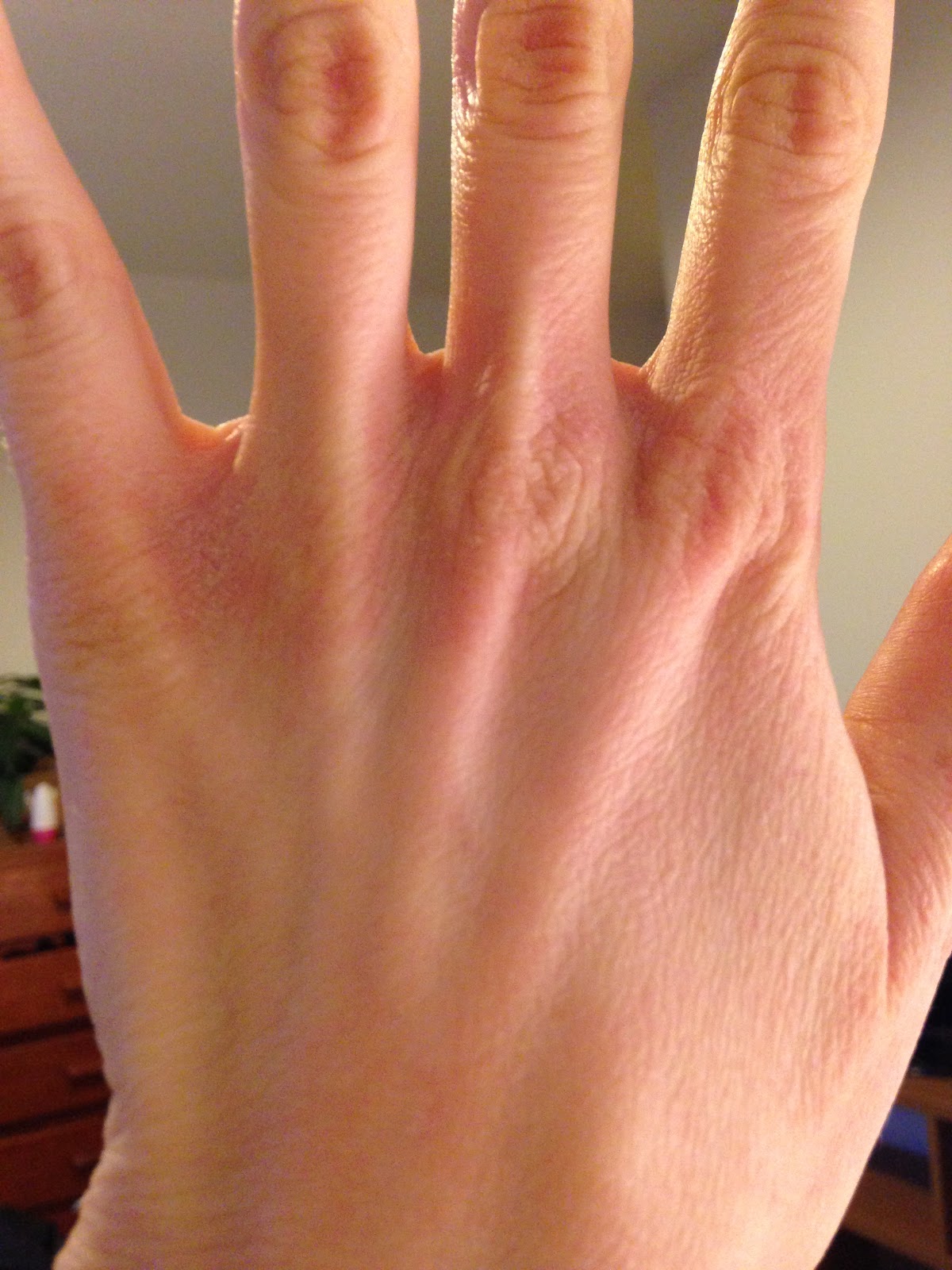 ForgetMeNotLane: Soothe those weather beaten hands!