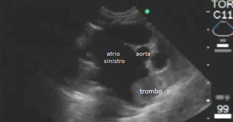 Infocardiovet: Video di un gatto cardiopatico con trombo nell'atrio ...