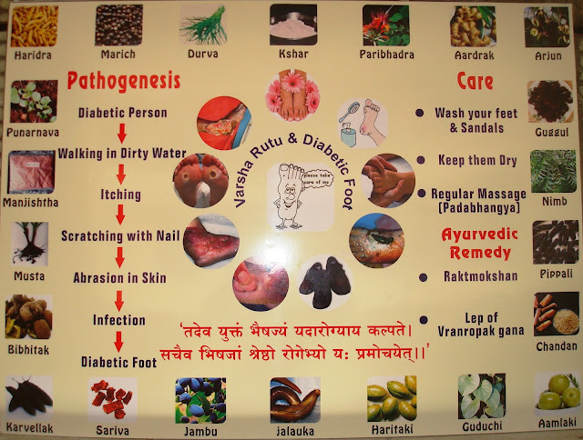Swasthya OPD @ TAMV: Varsha Ritu (Rainy season) Poster compition at TAMV