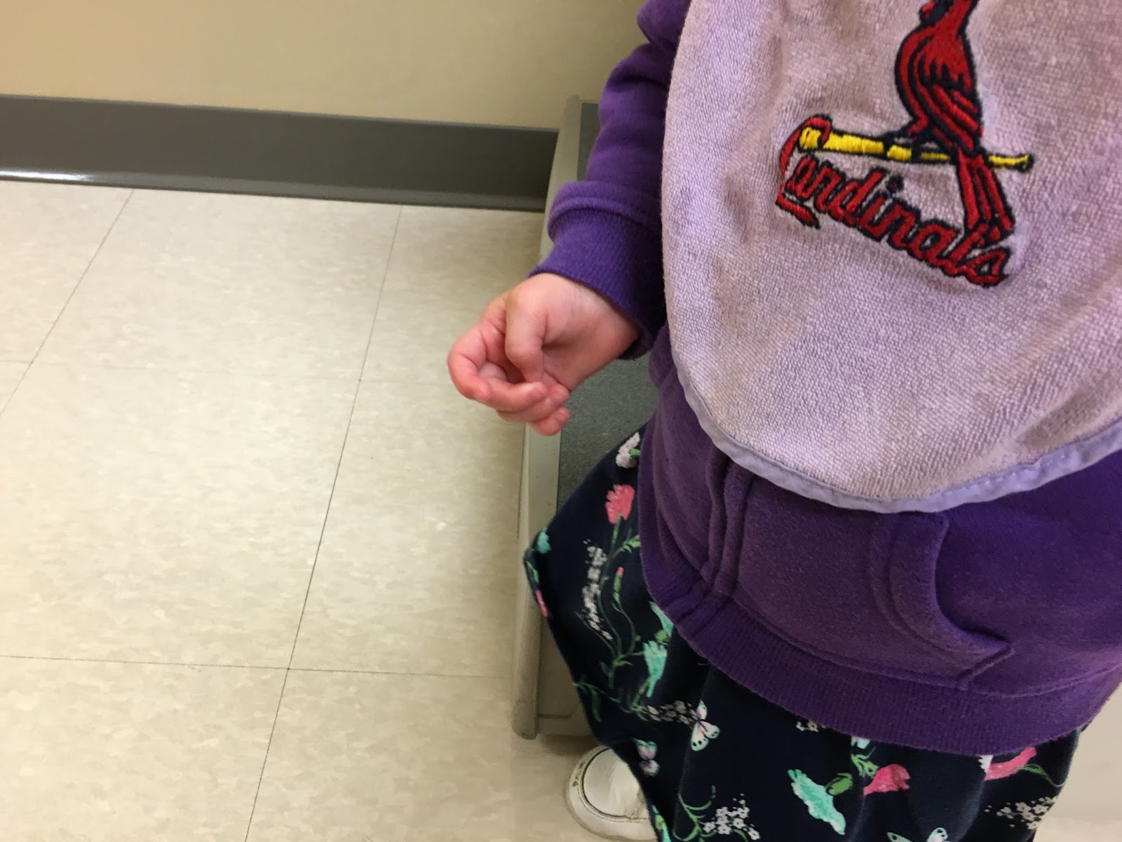 Clasped Thumb. | Congenital Hand and Arm Differences | Washington ...