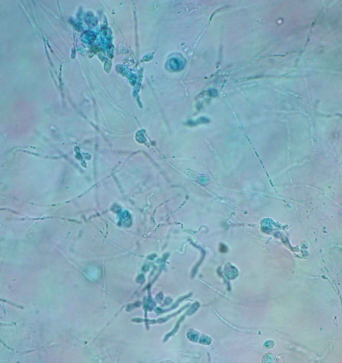 ATLAS MICOLOGIA: EPIDERMOPHYTON FLOCCOSUM