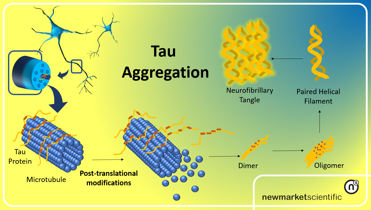Newmarket Scientific: Short Article on Alzheimer's Disease: #5 Tau ...