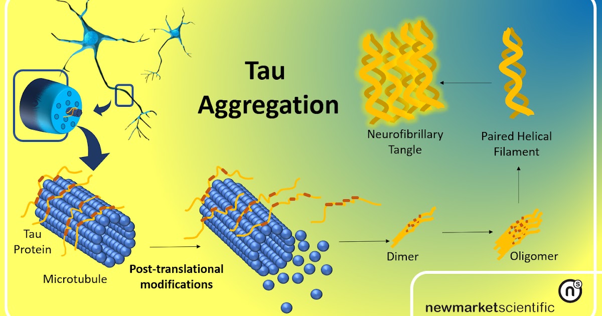 Newmarket Scientific: Short Article on Alzheimer's Disease: #5 Tau ...