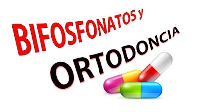 ¿QUE SON LOS BIFOSFONATOS