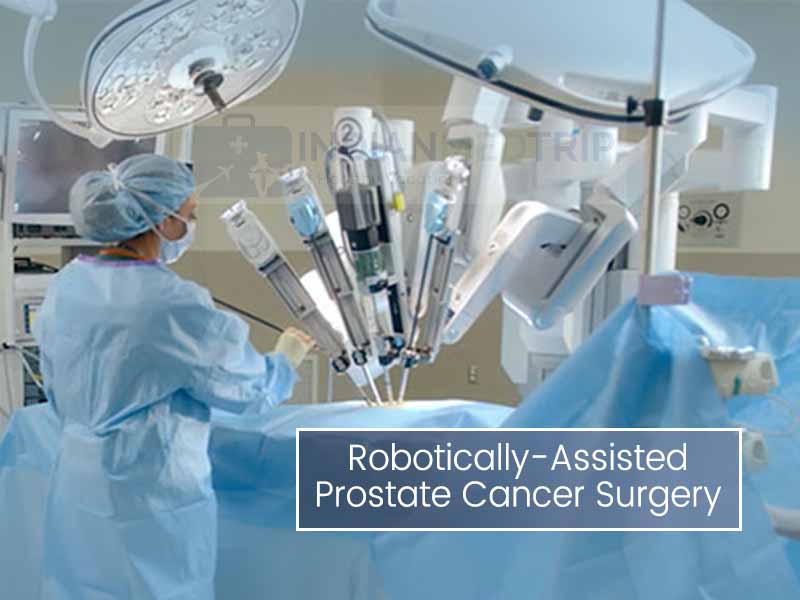 Robotically-Assisted Prostate Cancer Surgery in India ~ Healthcare In India