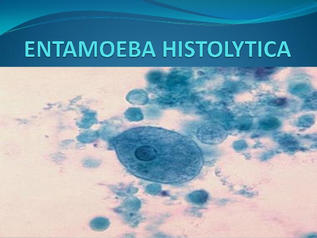 ENTAMOEBA HISTOLYTICA - Sama-Sama Belajar!