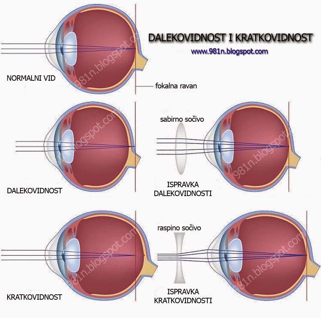 Dalekovidnost i kratkovidnost