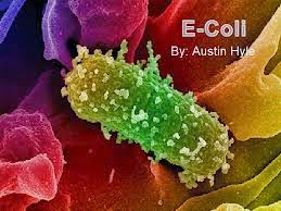 Ilmuku di Sekolah Kejuruan Analis Kesehatan: Bacteri E.Coli