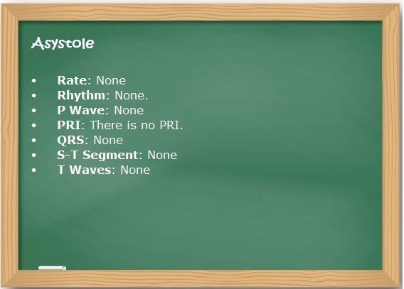 Float Nurse: Basic Rhythm Review: Ventricular Rhythms