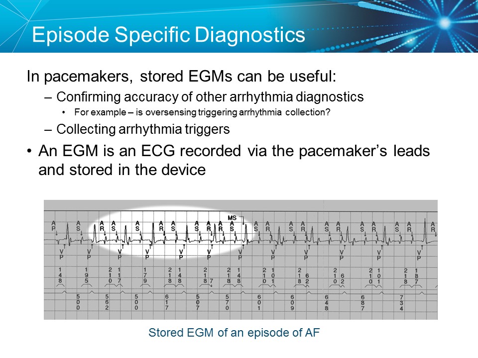 CVT Mohd Farid: Pacemaker Follow Up Part II-Medtronic Academy