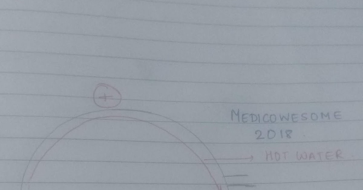 Medicowesome: Question: Caloric test