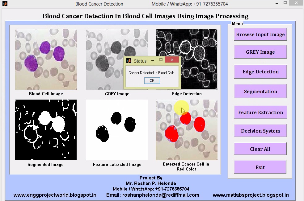 Leukemia Cancer Detection Using Image Processing Matlab Project Code ~ Matlab Projects