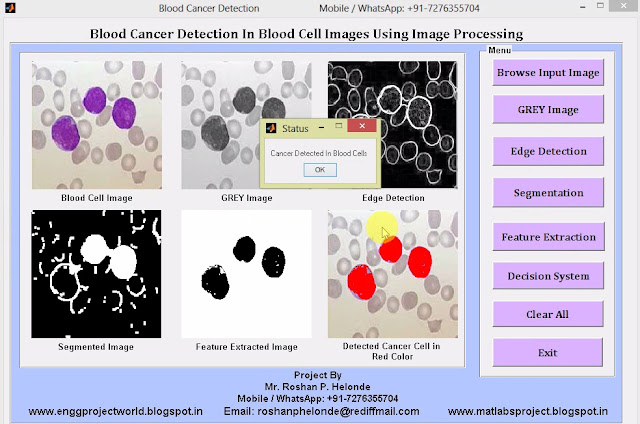 Leukemia Cancer Detection Using Image Processing Matlab Project Code ~ MATLAB PROJECTS
