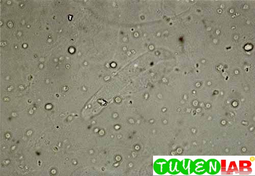 Atlas of Casts in urine | Free Medical Atlas