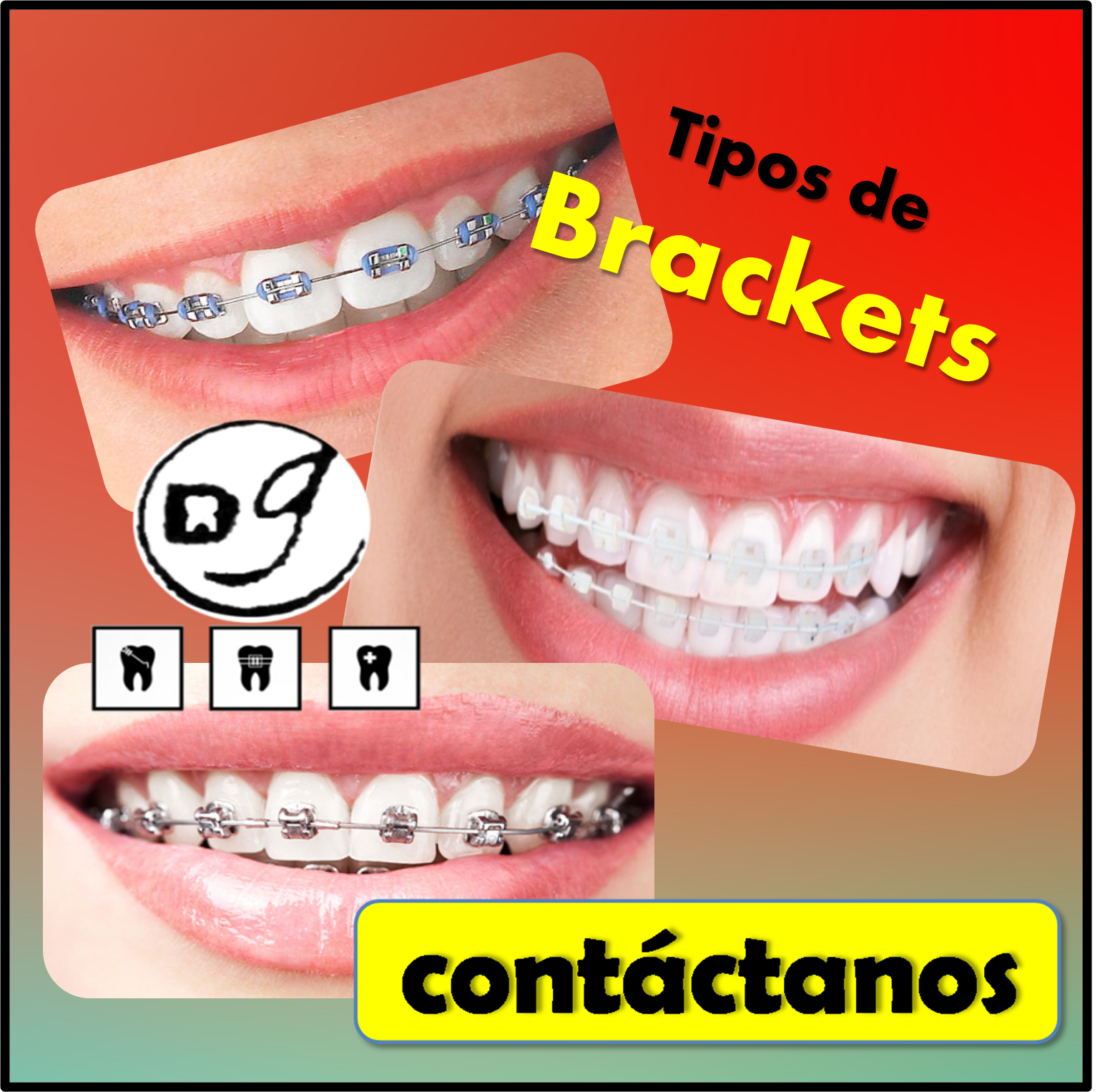 Dental G, Porque Tu Salud y Tu Sonrisa Lo Valen..: Principales Tipos de ...
