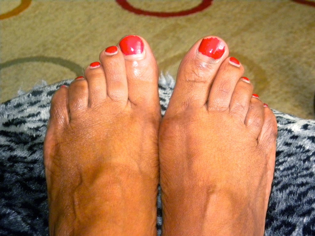 Changing Direction - Fashion and Lifestyle Blog: Let's talk UGLY feet ...