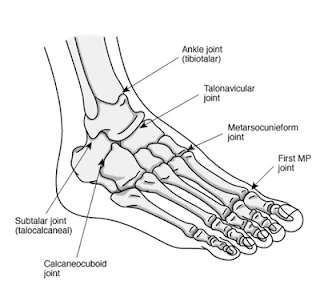 Human skeleton anatomy: Congenital Talipes Equinovarus Clubfoot
