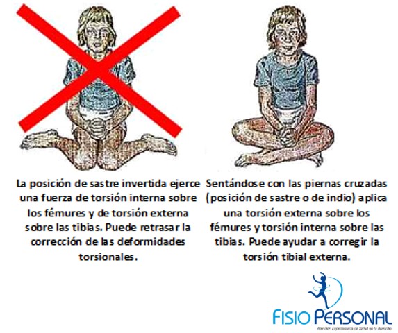 Fisiopersonal: TRATAMIENTO PIERNAS ARQUEADAS O EN PARÉNTESIS Y PIERNAS ...