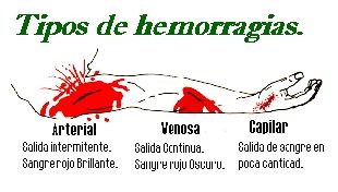 PRIMEROS AUXILIOS: HEMORRAGIAS