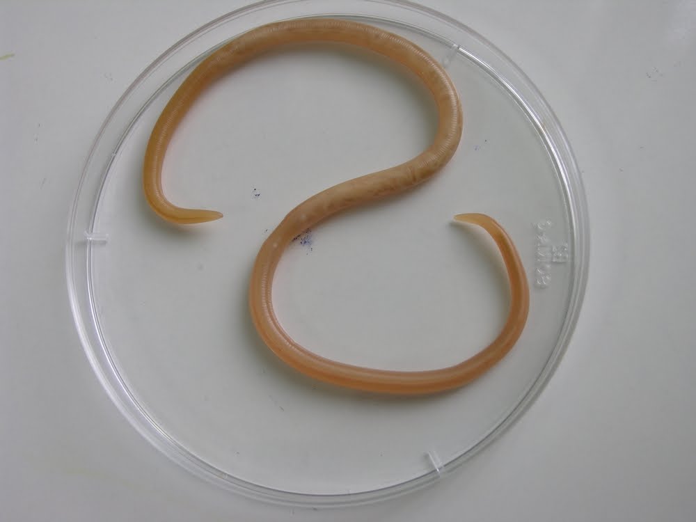 ASCARIS LUMBRICOIDES Y TRICHURIS TRICHIURA
