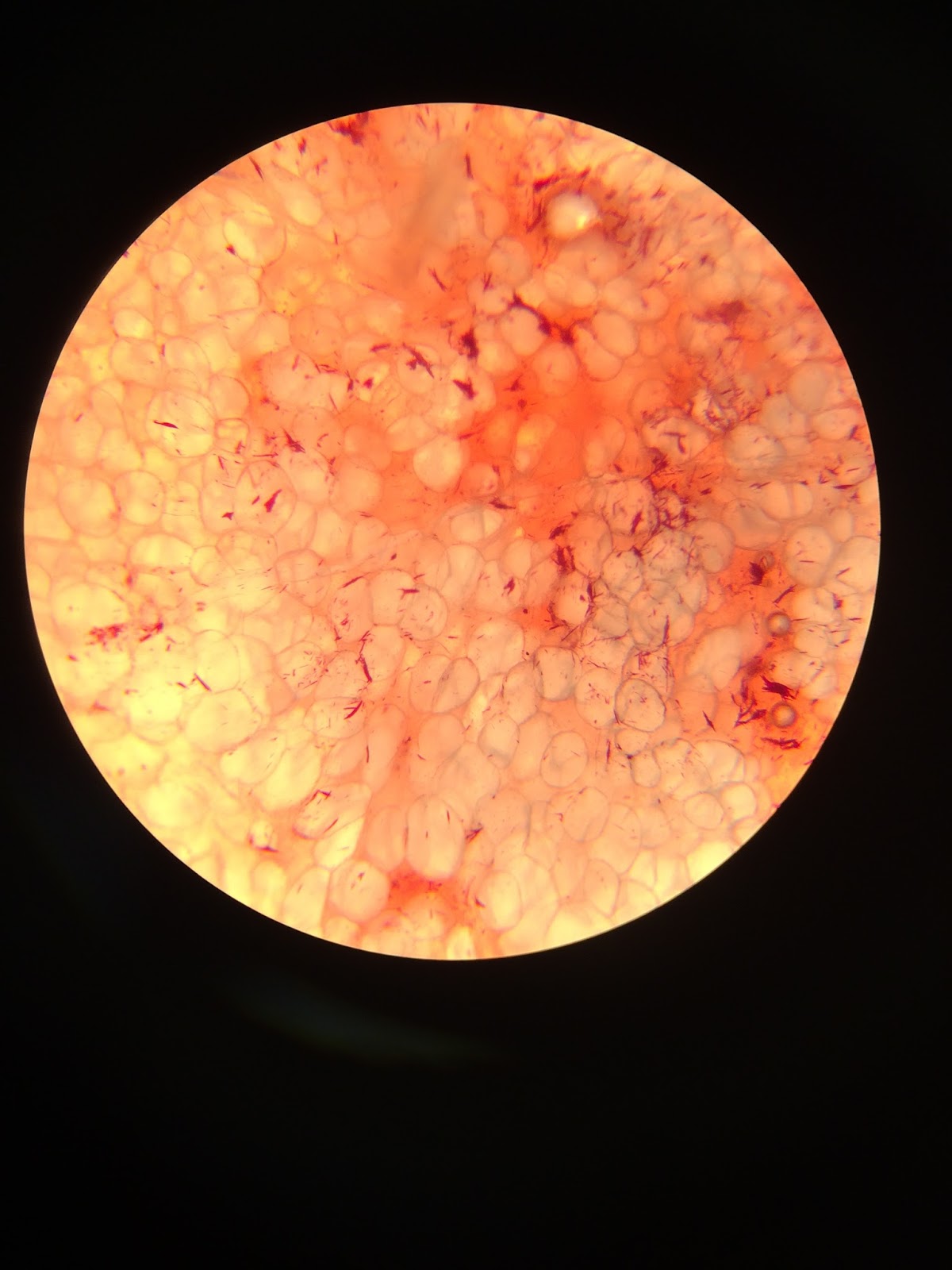 Anatomía, Clara: OBSERVACIÓ D'ADIPÒCITS. 15-10-2016