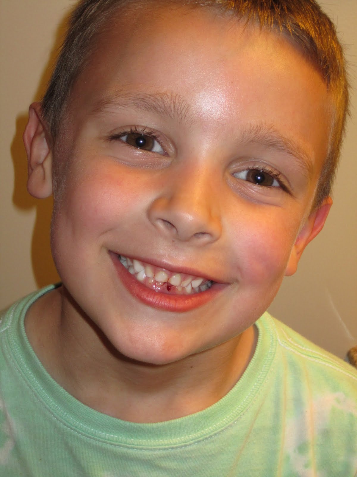 Me and the boys: Lost Tooth!!